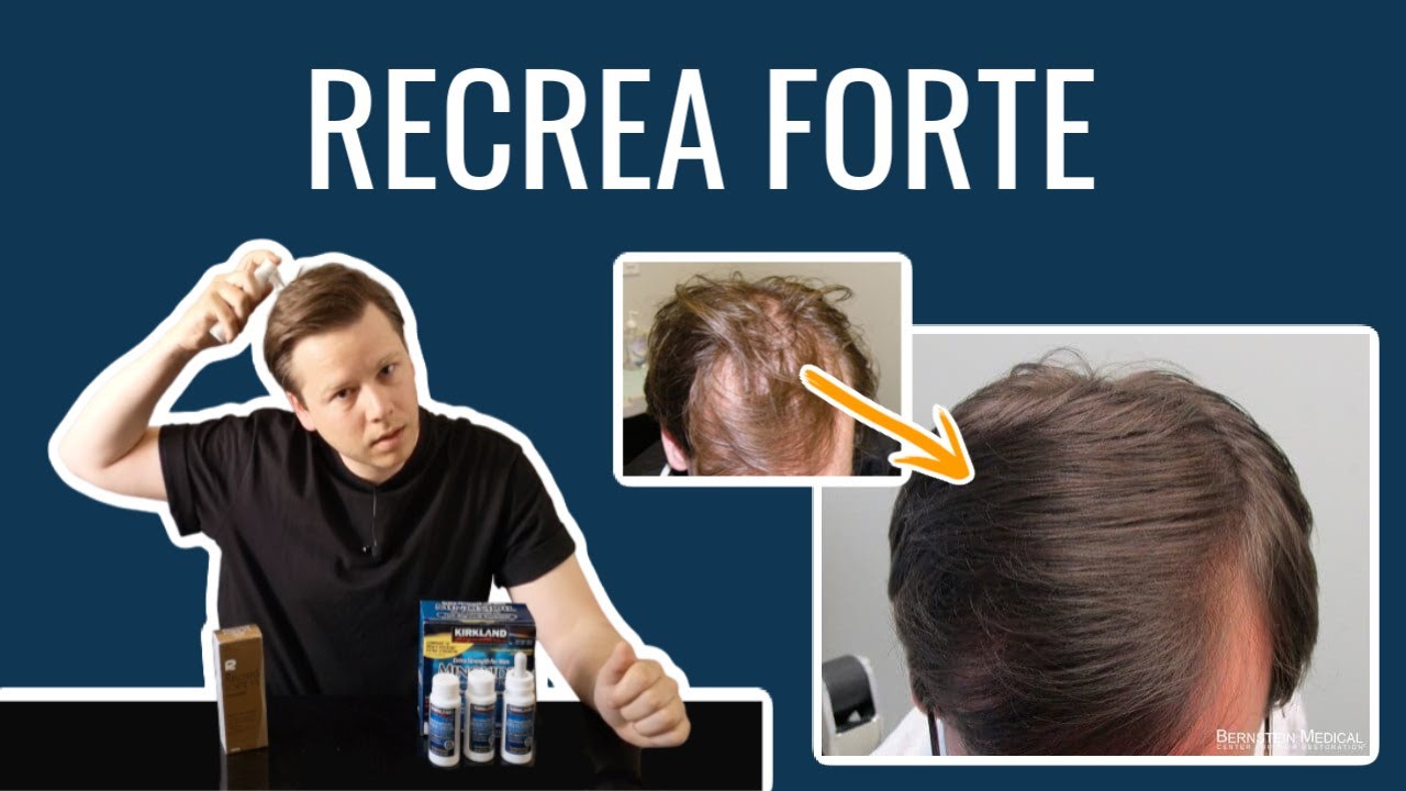 🥇 Recrea Forte: Den ultimate guiden for en aktiv og sunn livsstil